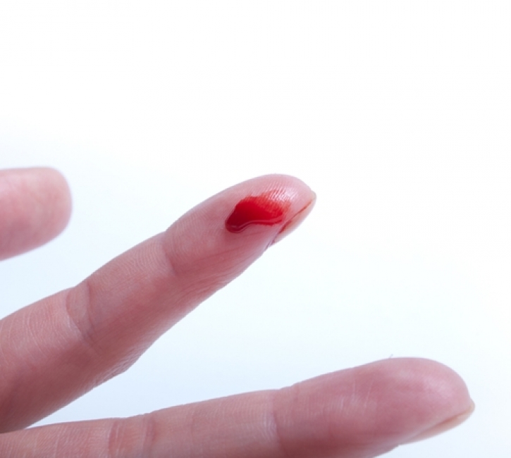 Treating and preventing common kitchen injuries | Escoffier Online ...